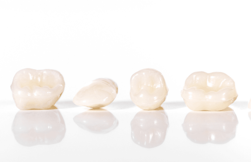 Plomby amalgamatowe - czy są bezpieczne i jak je usuwać? -PrecisDENT ...