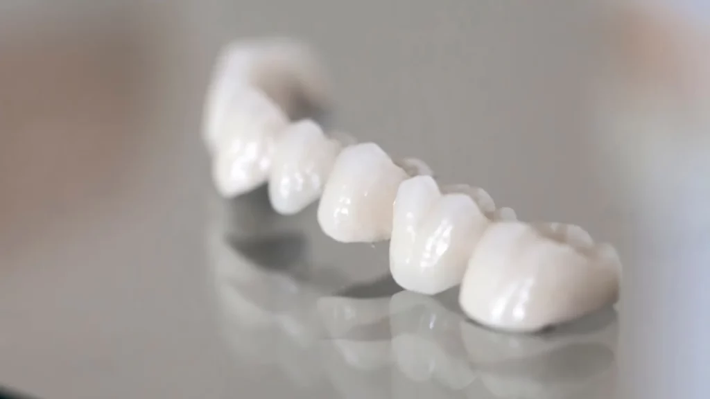 Korony cyrkonowe: Zalety, wady i czy są warte inwestycji? - PrecisDENT ...